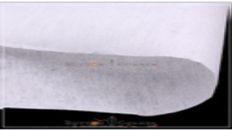 Paper Fusing – Button Corner